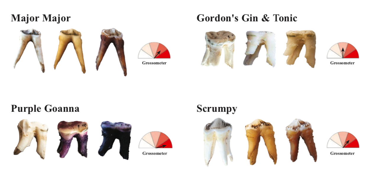 A Time-controlled Study on the RTD-Teeth-Grossness Connection ...