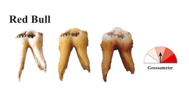 A Time-controlled Study on the RTD-Teeth-Grossness Connection ...